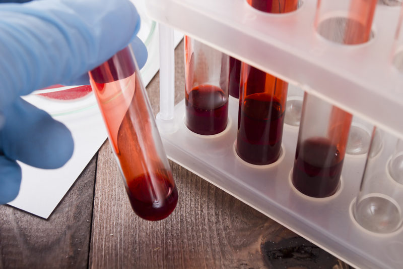 Concerns over Blood Tests by Forensic Science Company - Ison Harrison ...